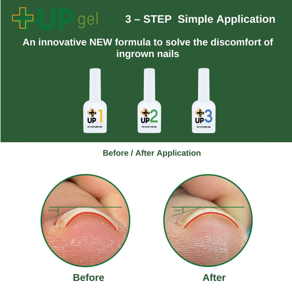 Up Gel Set – GellyFitUSA